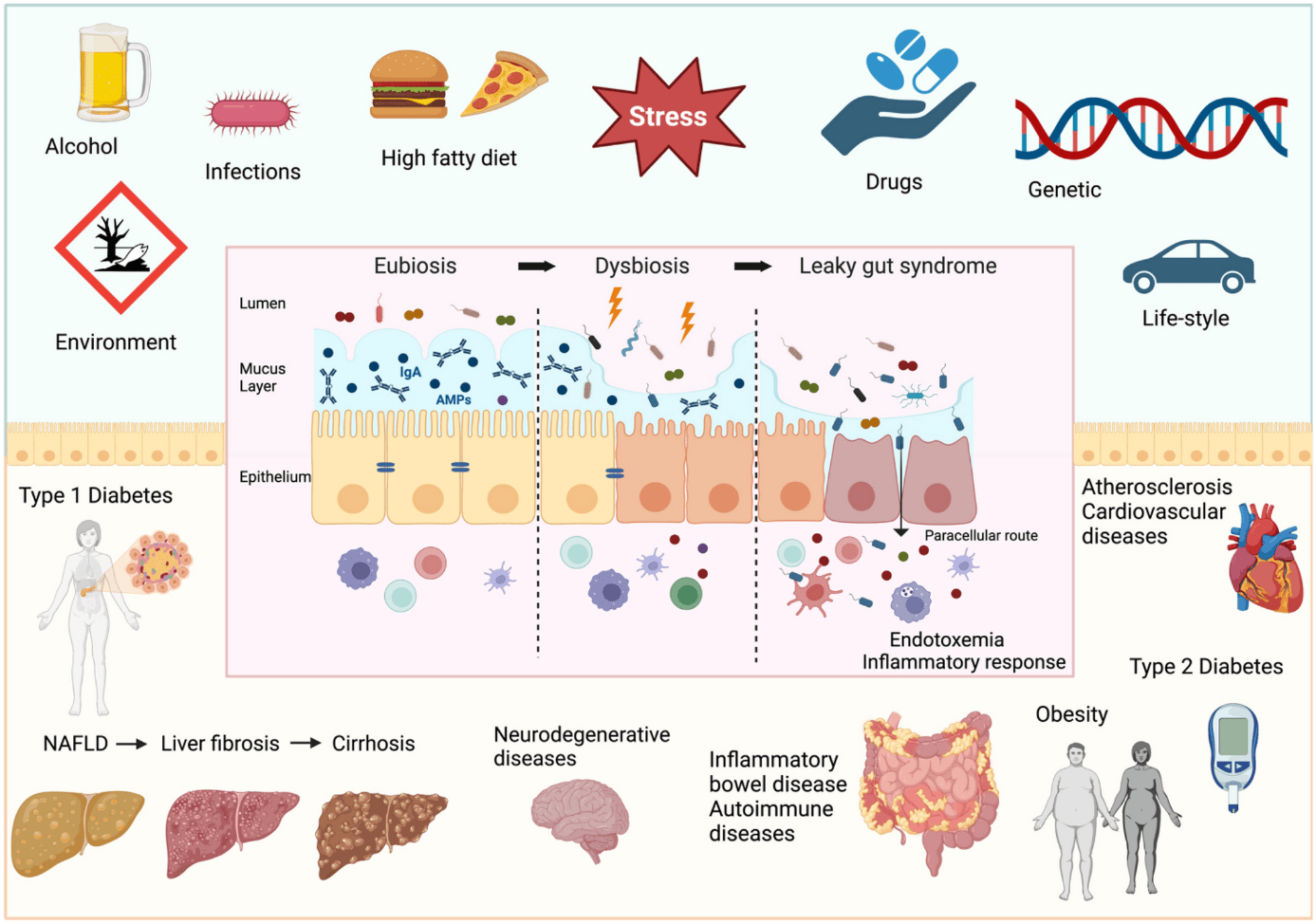 Leaky Gut Syndrome: Causes, Symptoms, and Solutions for Gut Healing ...